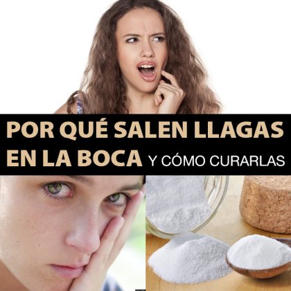 Por qué salen llagas en la boca y cómo curarlas - La Guía de las Vitaminas