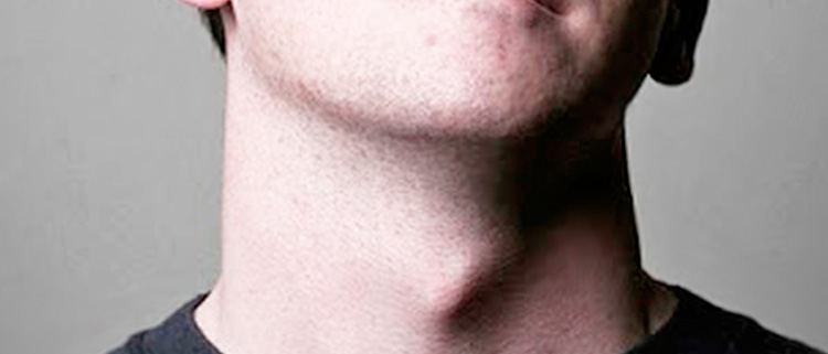 6 signos de testosterona alta en hombres - La Guía de las Vitaminas