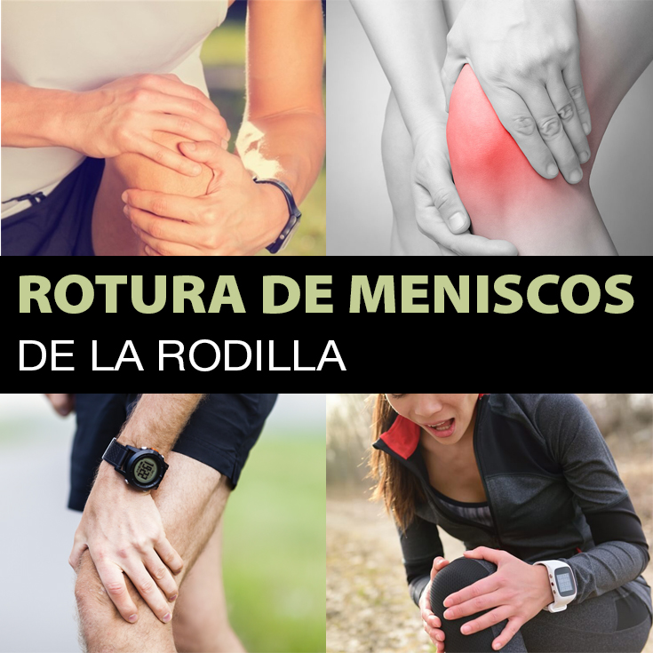 Rotura de meniscos de la rodilla: causas, síntomas y tratamiento - La ...