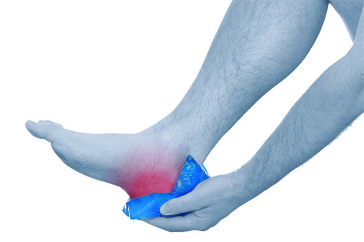 Dolor En Los Talones: Causas, Sintomas y Tratamiento - La Guía de las ...