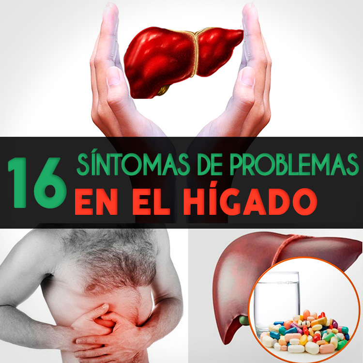 16 Señales De Que Tienes Problemas En El Hígado - La Guía de las Vitaminas