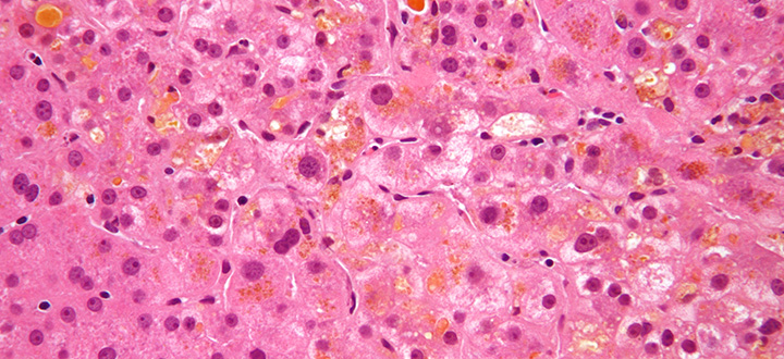 Heces verdes: qué te están diciendo de tu salud - La Guía de las Vitaminas