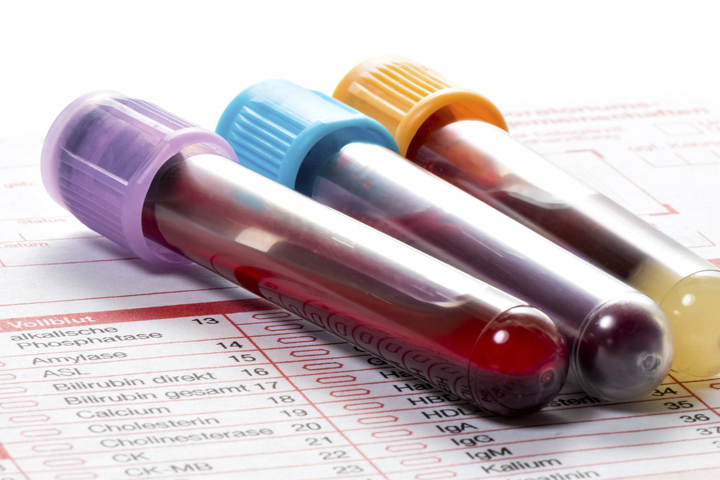 Infección En La Sangre: Síntomas, Causas Y Tratamiento - La Guía de las ...