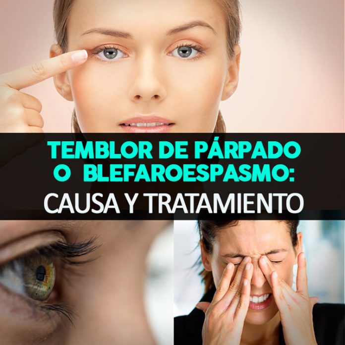 Temblor de párpado o blefaroespasmo: causas, tratamiento y prevención ...