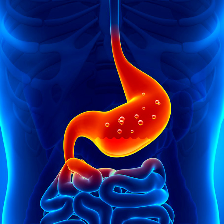 Magaldrato: para qué sirve, efectos secundarios, dosis y usos - La Guía ...