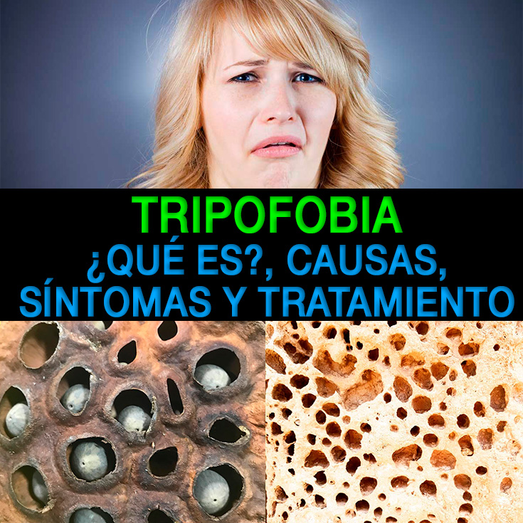 Tripofobia: qué es, causas, síntomas y tratamiento - La Guía de las ...