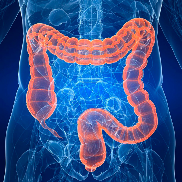 Colitis ulcerativa: causas, síntomas y tratamiento - La Guía de las ...