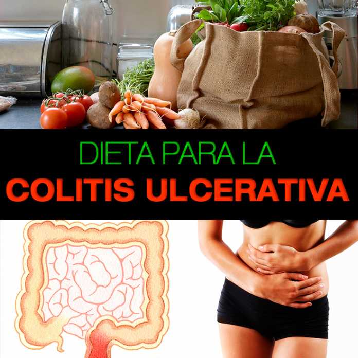 Dieta para la colitis ulcerativa: alimentos, suplementos y remedios ...