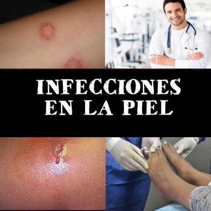 Infecciones en la piel: tipos, causas, síntomas y tratamientos - La ...