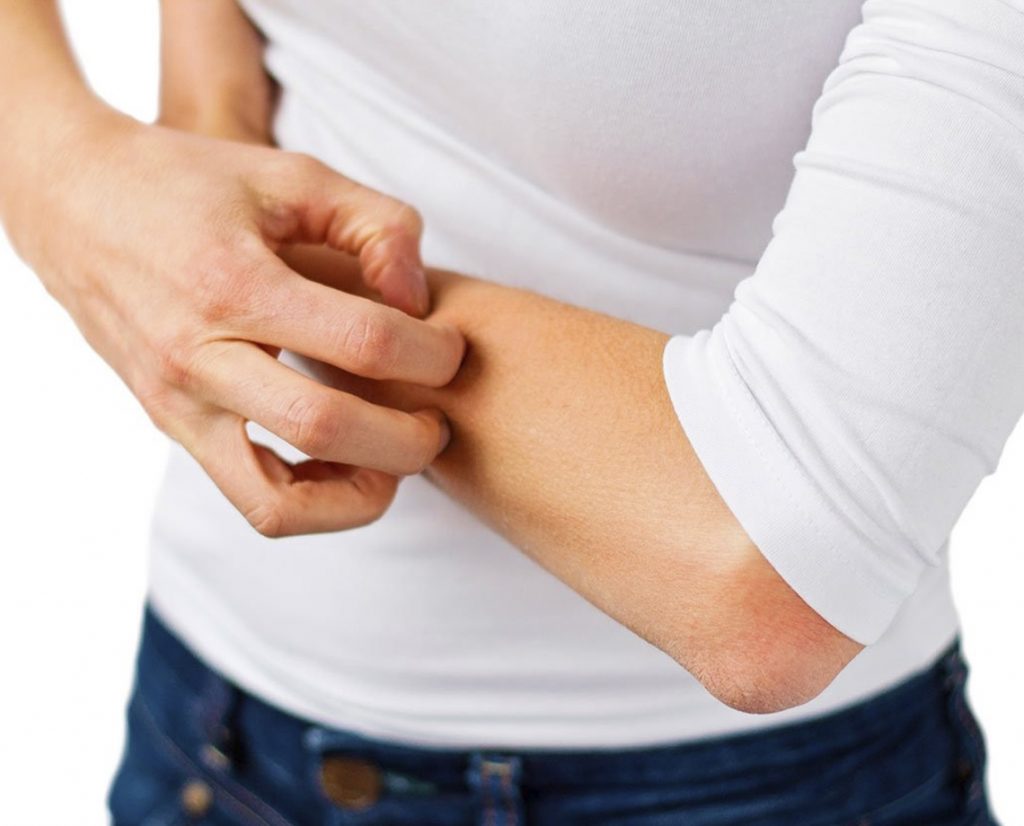 Erupción cutánea: causas, fotos, tipos y tratamiento - La Guía de las ...