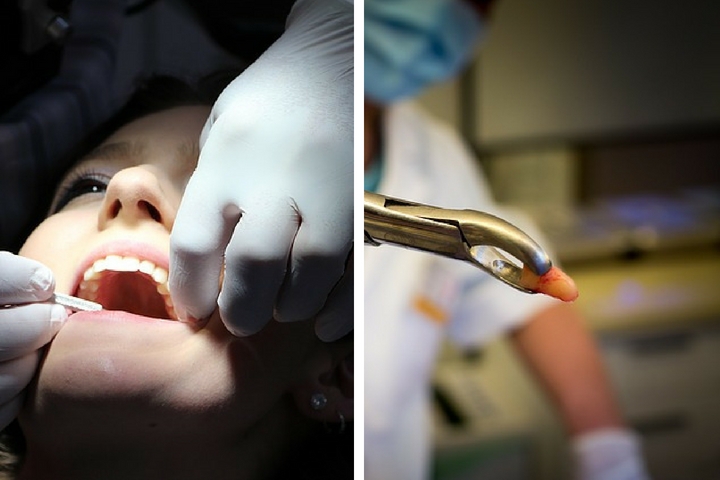 Extraccion | La Guía de las Vitaminas