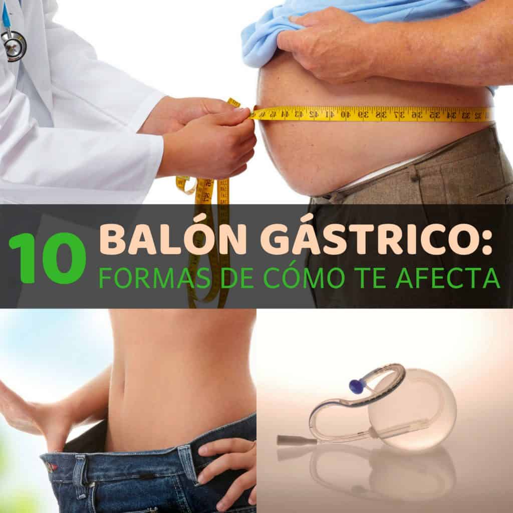 Balón gástrico: 10 cosas que ocupas saber antes de operarte - La Guía ...
