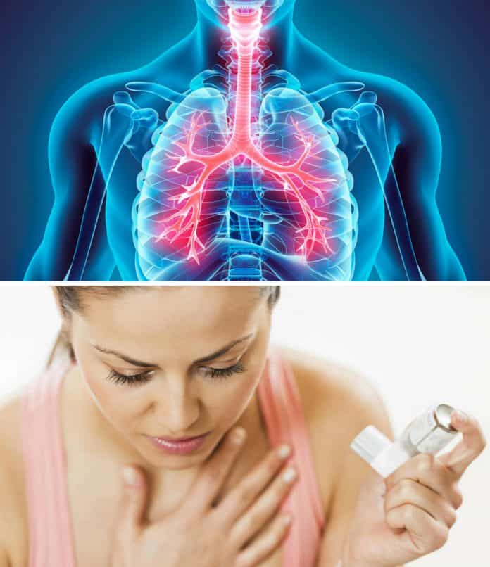 Ambroxol con salbutamol: para qué sirve, efectos secundarios, beneficios y dosis - La Guía de ...