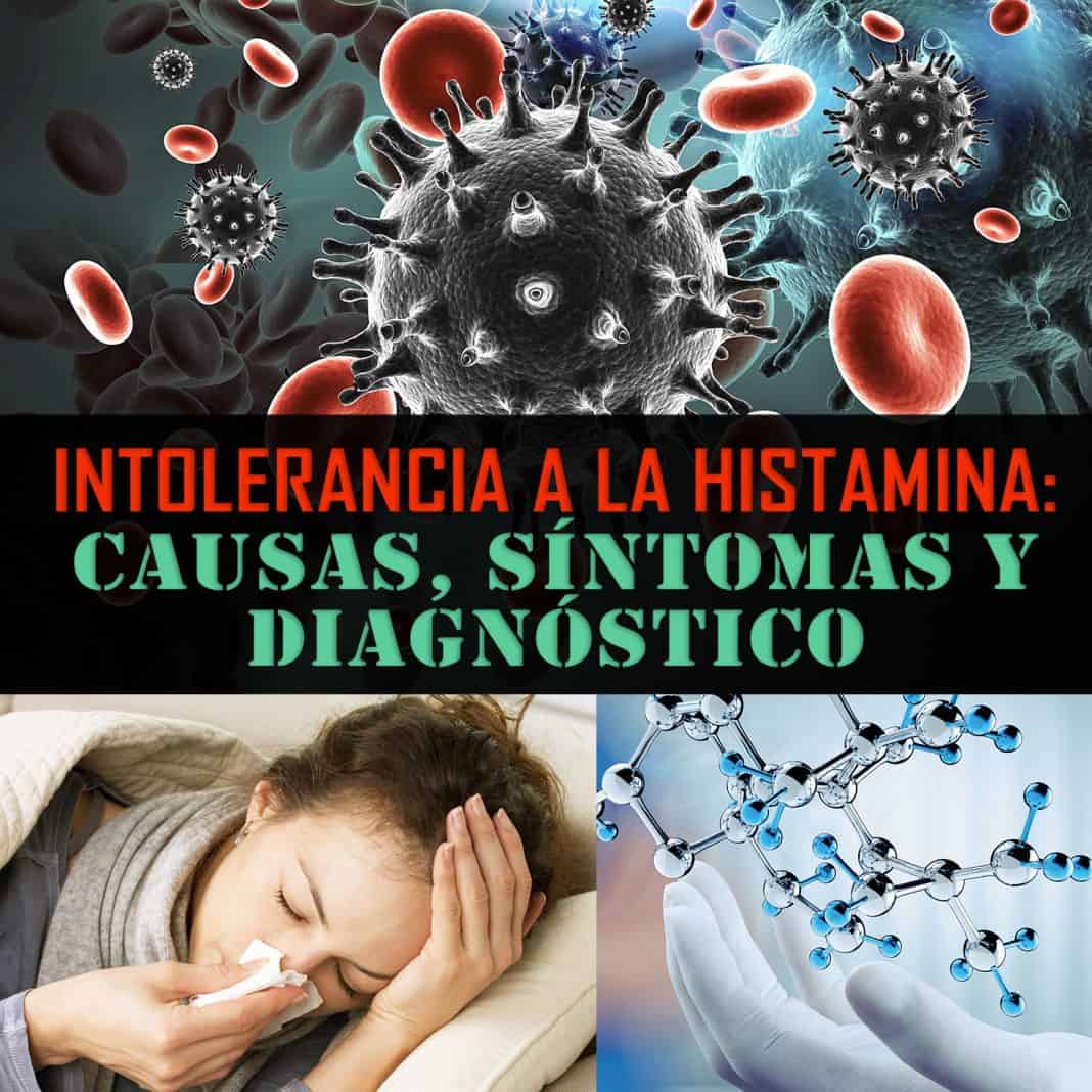 Intolerancia a la histamina: causas, síntomas y diagnóstico - La Guía ...