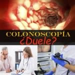 ¿Hacerte una colonoscopia duele mucho? - La Guía de las Vitaminas