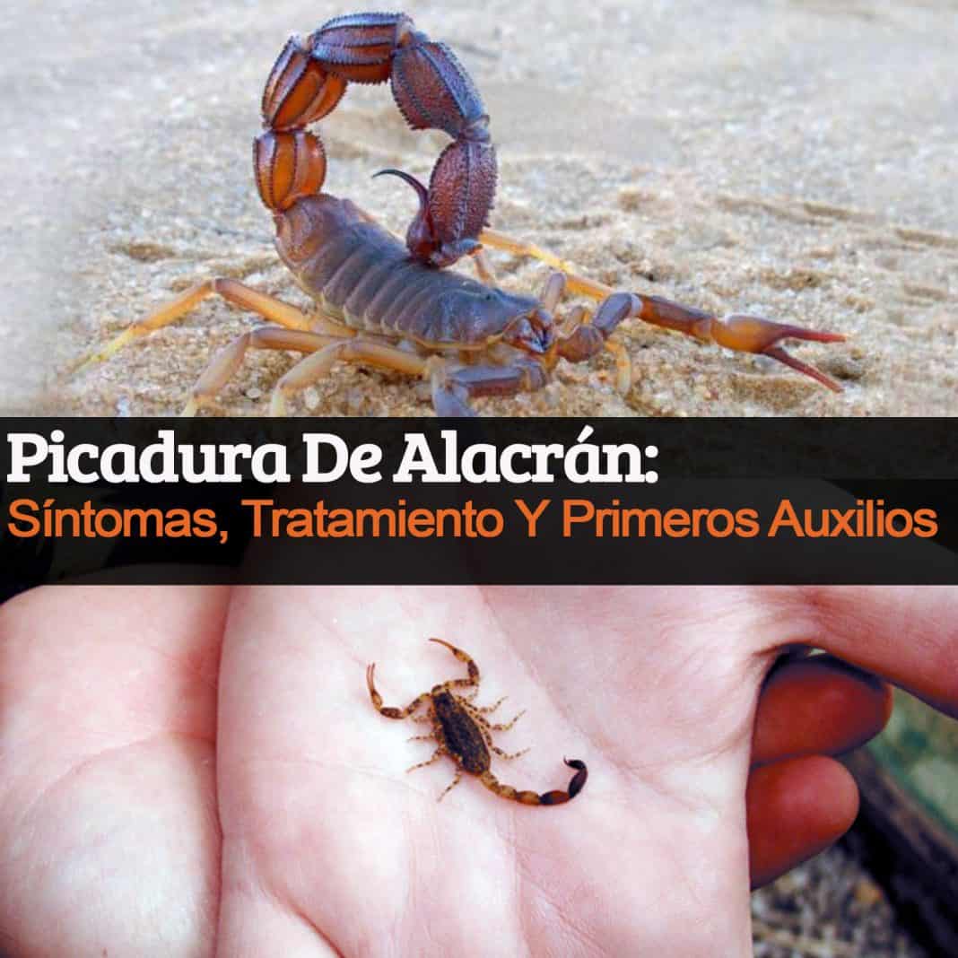 Picadura de alacrán: síntomas, qué hacer, tratamiento y primeros ...