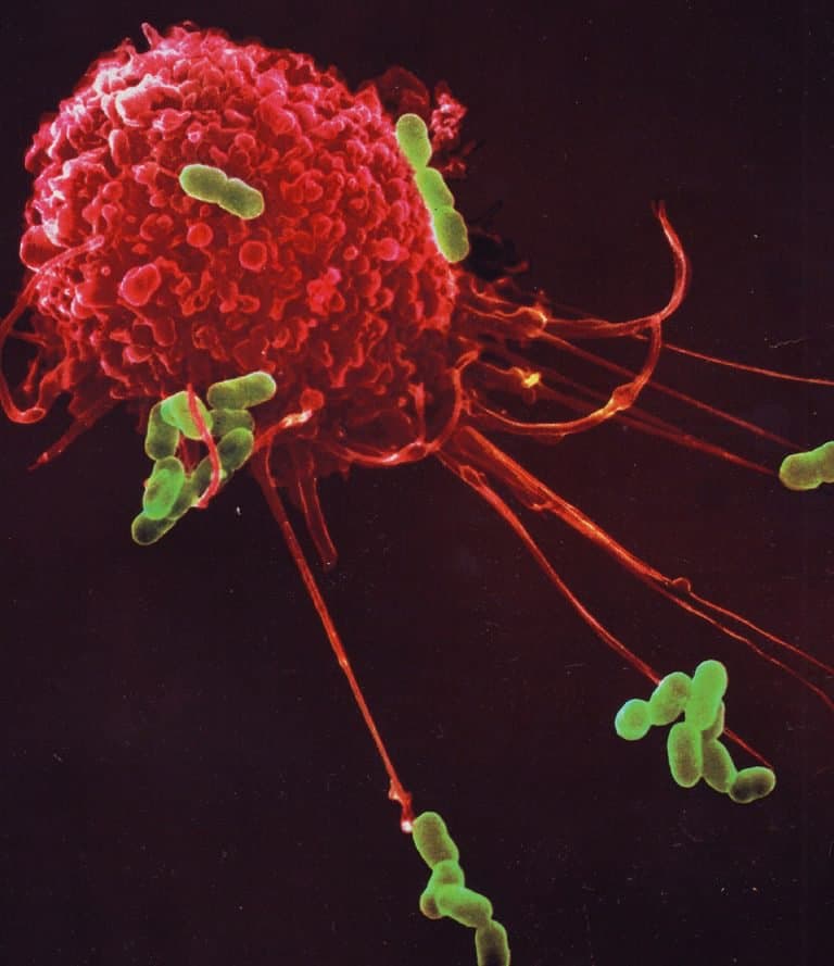 Histamina: qué es, para qué sirve y cómo se relaciona con las alergias ...