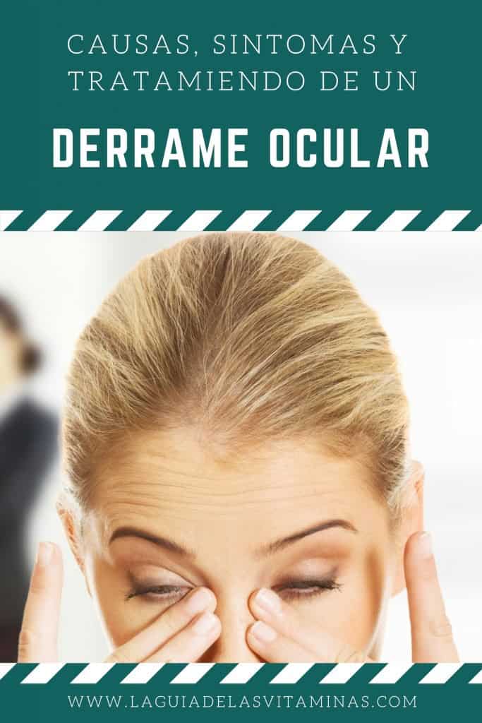 Derrame ocular: causas, síntomas y tratamiento - La Guía de las Vitaminas